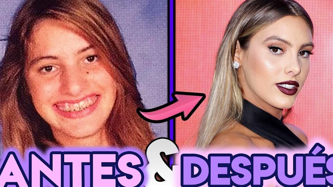Lele Pons antes y después de la cirugía en 2023